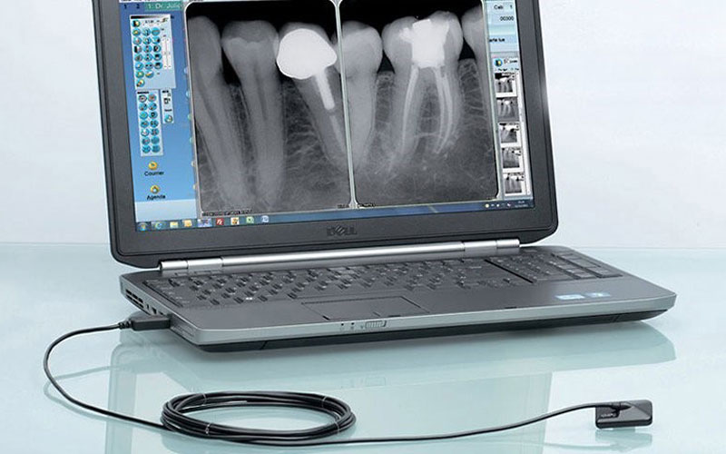 معرفی بهترین سنسور RVG دندانپزشکی • متا راز » متا راز